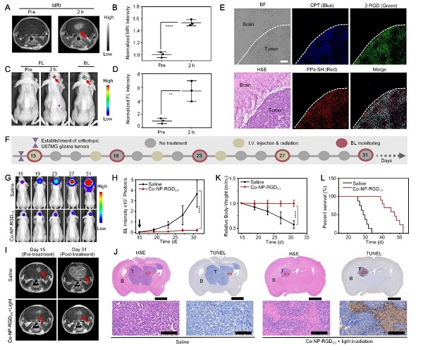 上海药物所等开发纳米探针用于脑胶质瘤的成像与治疗----中国科学院